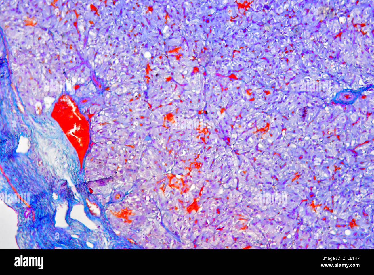 Human ovary section showing corpus luteum. Optical microscope X100 ...