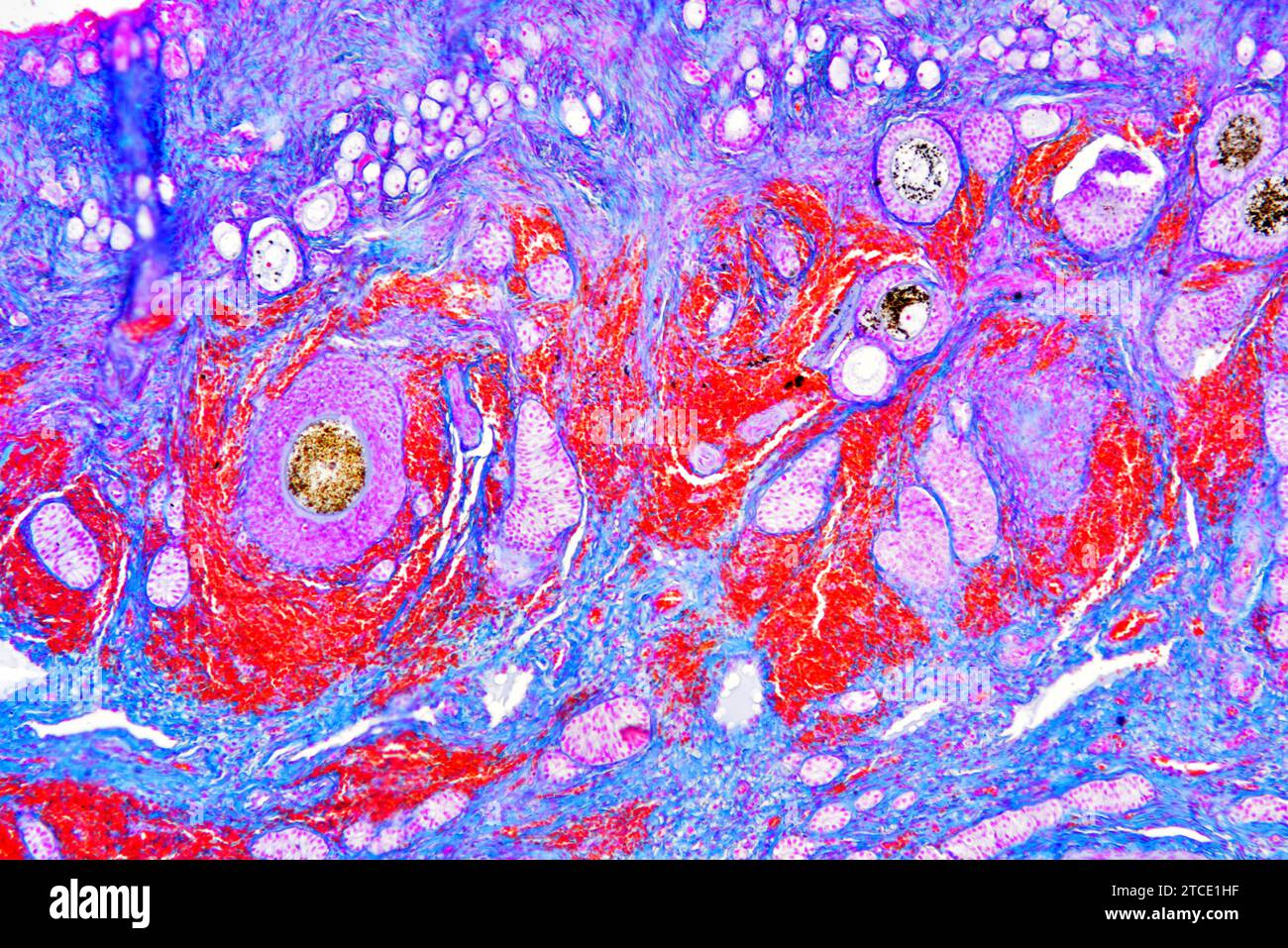 Human ovary section showing ovarian follicles or Graaf follicles ...