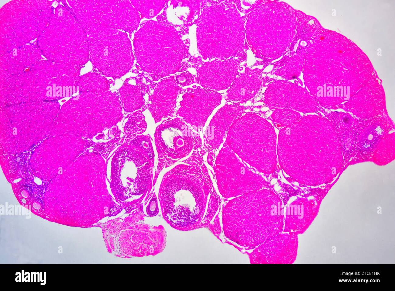 Ovary section showing corpus luteum, stroma, epithelium and follicles ...