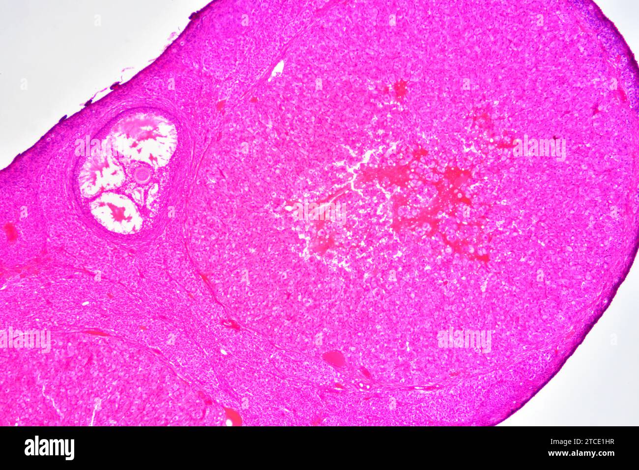 Ovary section showing corpus luteum, stroma, epithelium and follicles ...