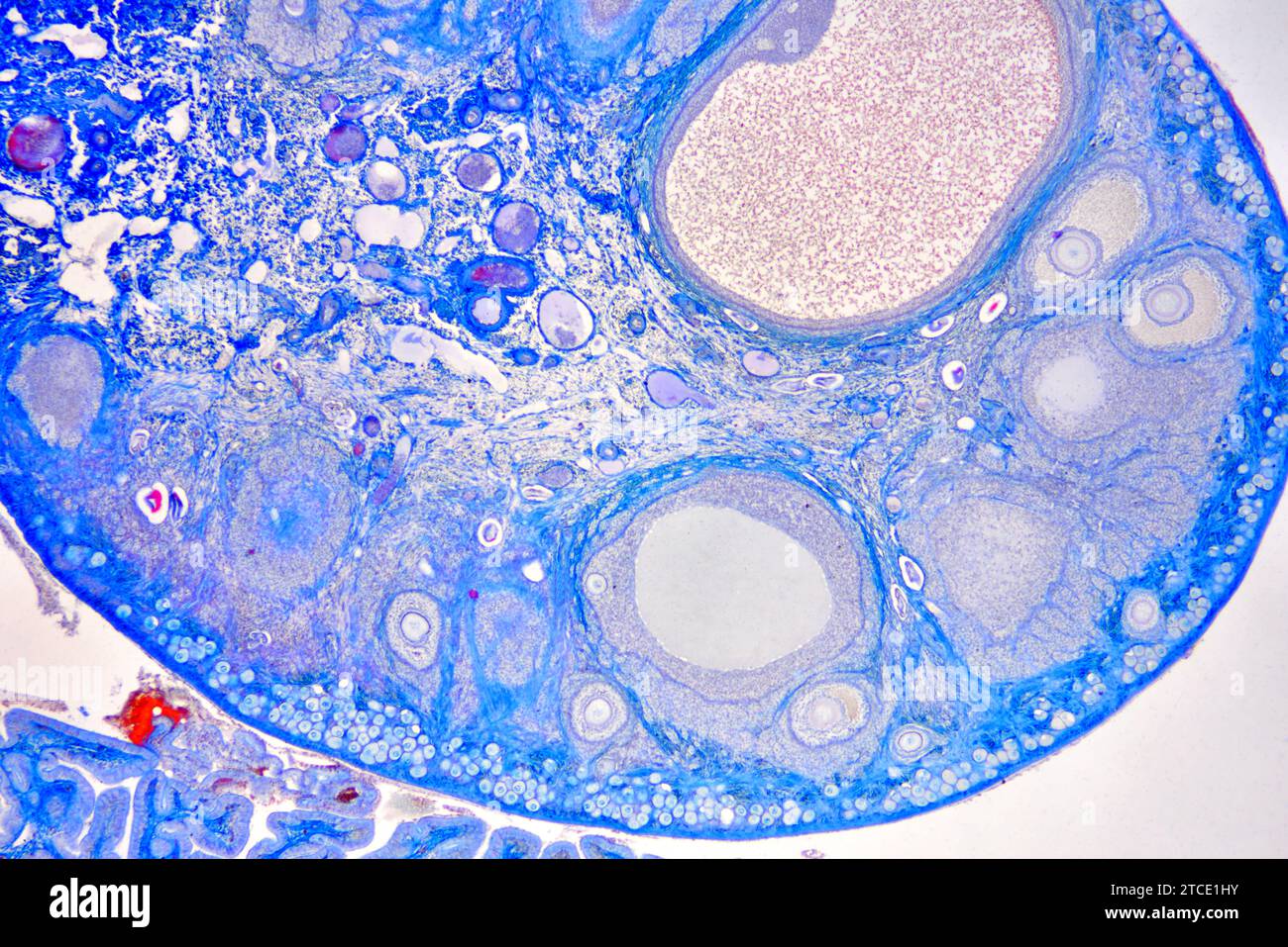 Ovary section showing corpus luteum, stroma, epithelium and follicles ...
