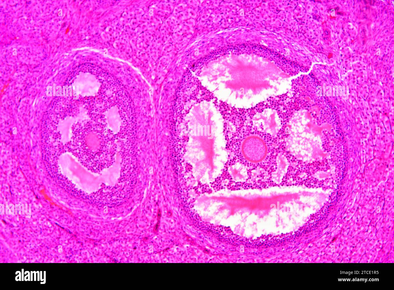 Histology ovarian follicle hi-res stock photography and images - Alamy
