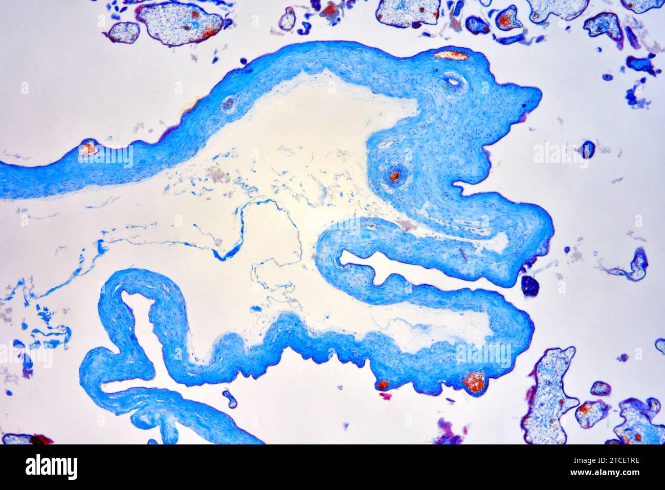 Human placenta section. Optical microscope X40 Stock Photo - Alamy