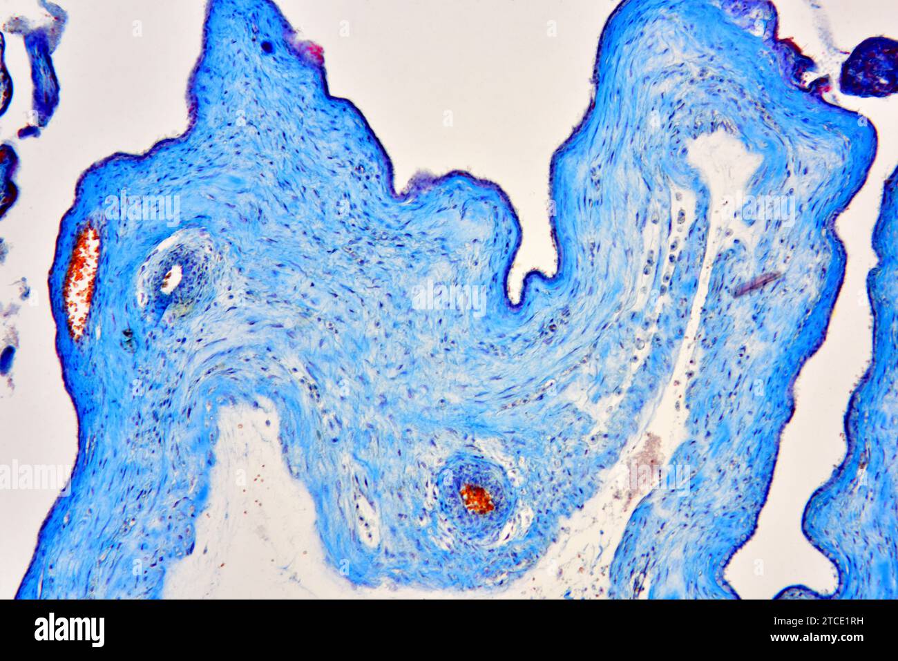 Human placenta section. Optical microscope X100 Stock Photo - Alamy