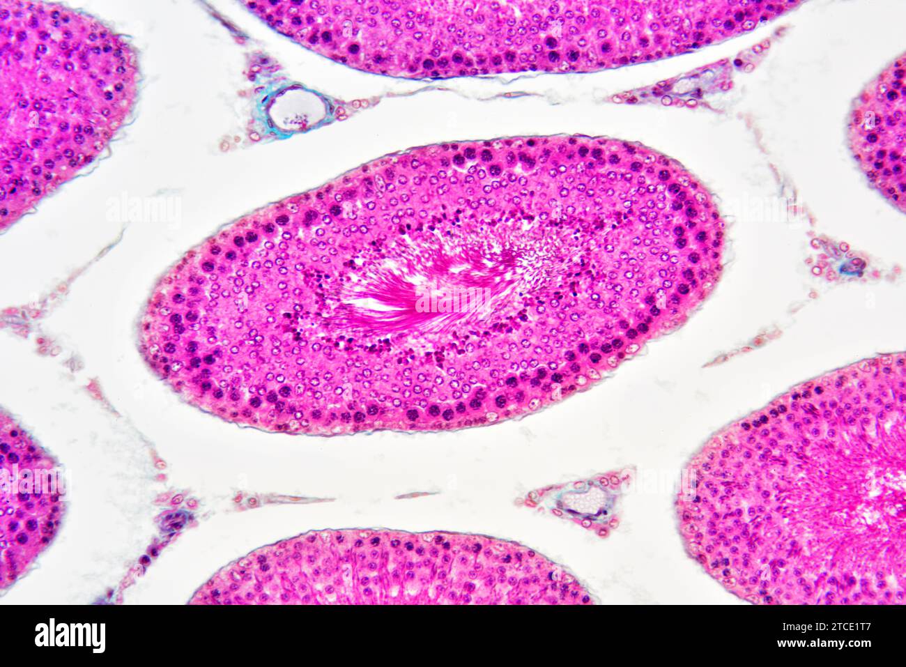 Human testicle or testis section showing seminiferous tubules, Leydig ...