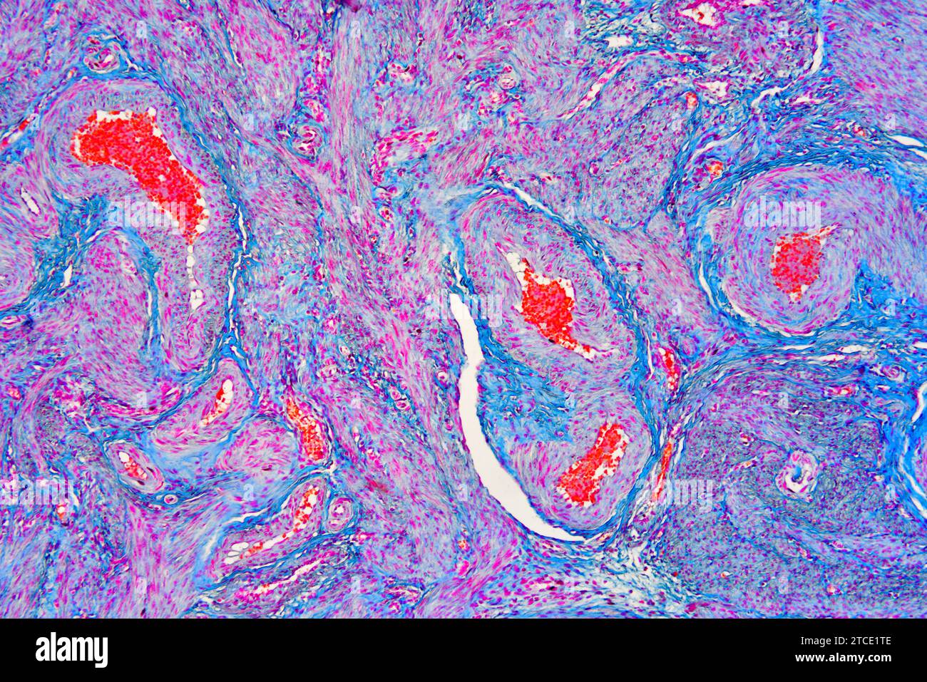 Human uterus hi-res stock photography and images - Alamy