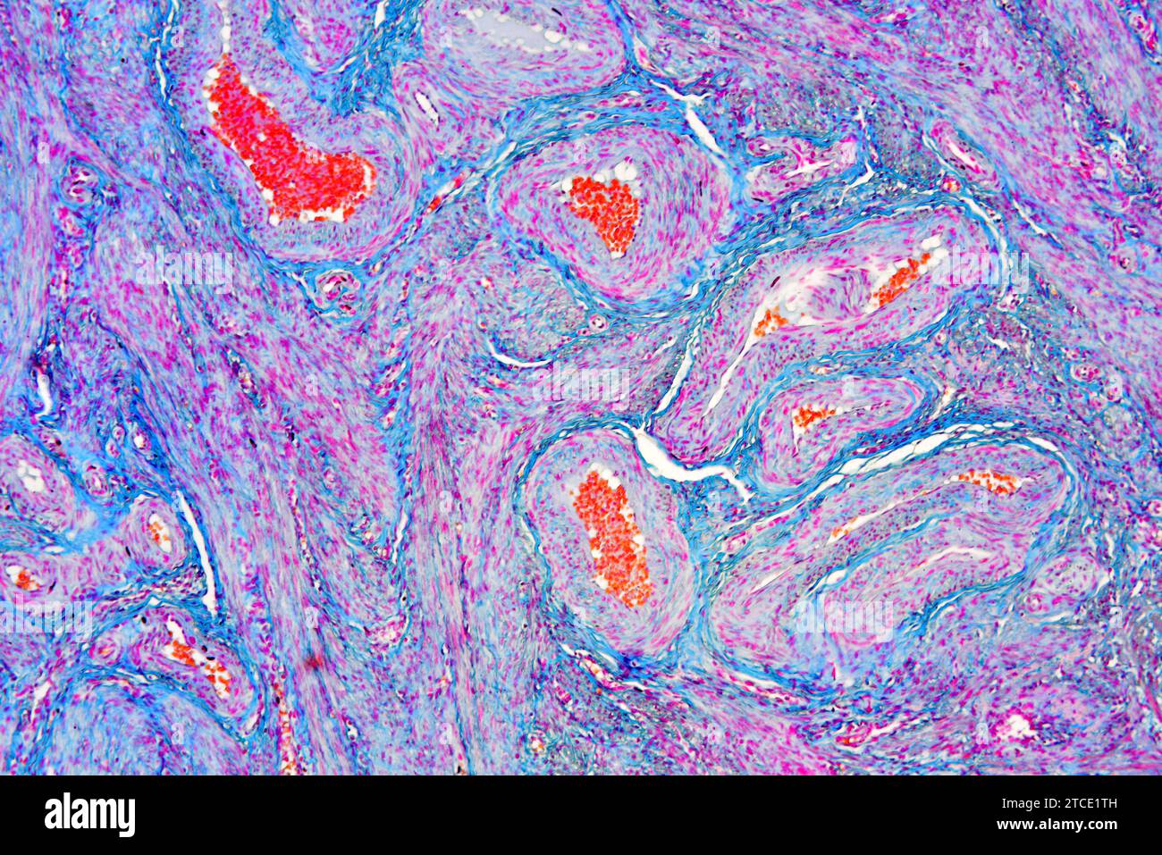 Human uterus or womb. Optical microscope X100 Stock Photo - Alamy