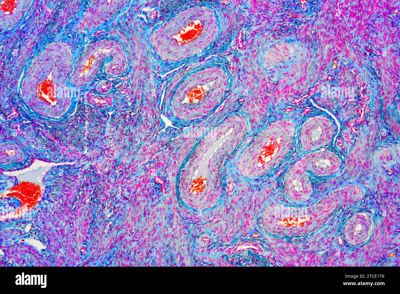 Human uterus or womb. Optical microscope X100 Stock Photo - Alamy