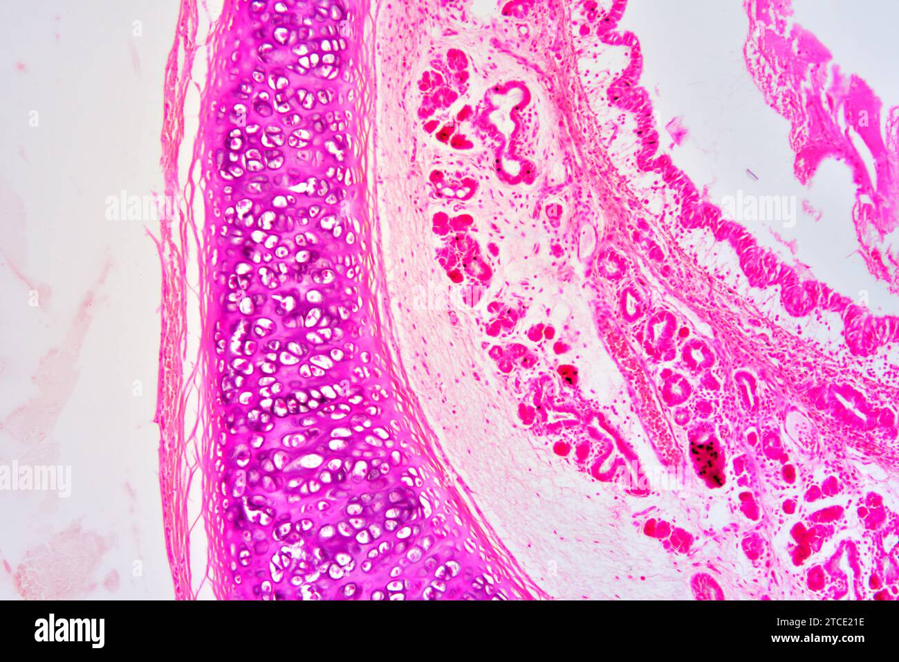Trachea or windpipe cross section. Optical microscope X100 Stock Photo ...