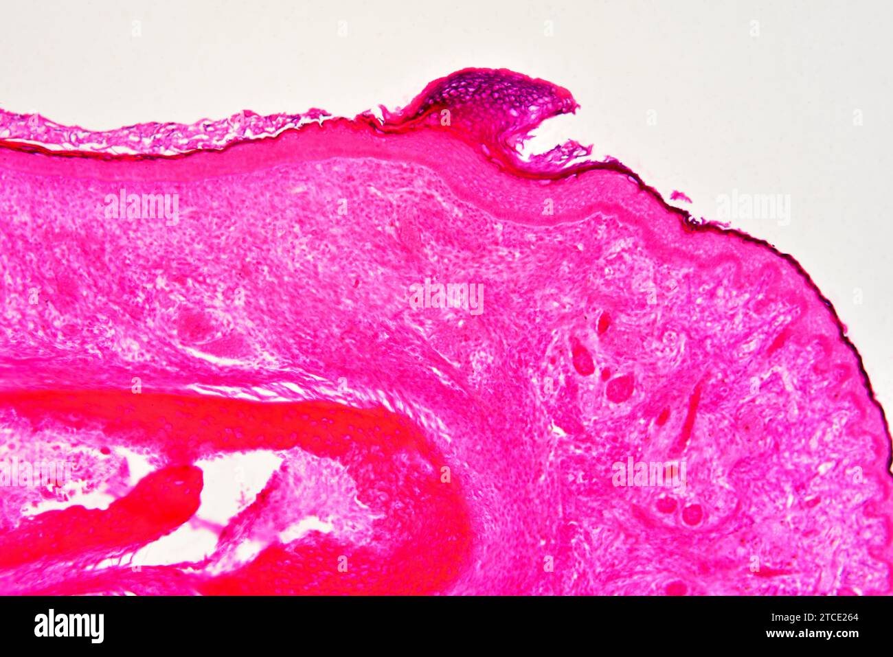 Histology of bone hi-res stock photography and images - Alamy