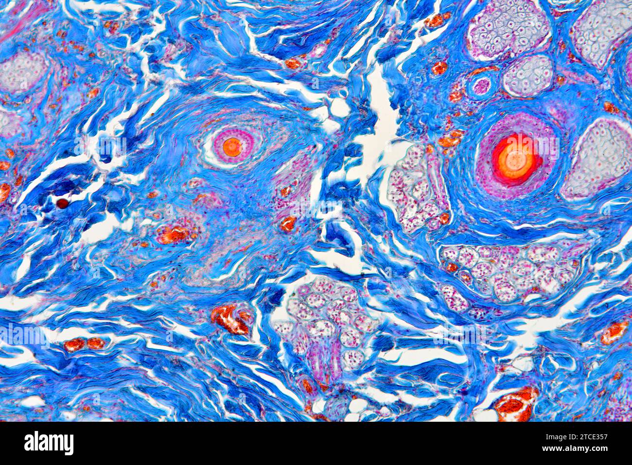 Human scalp cross section showing hair follicles, sebaceous glands and ...