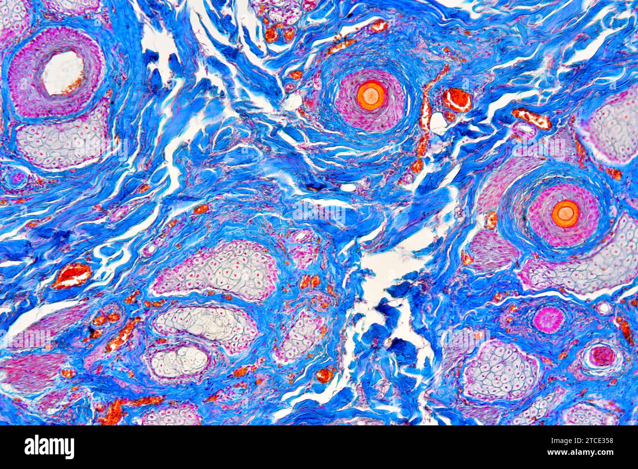 Human scalp cross section showing hair follicles, sebaceous glands and ...