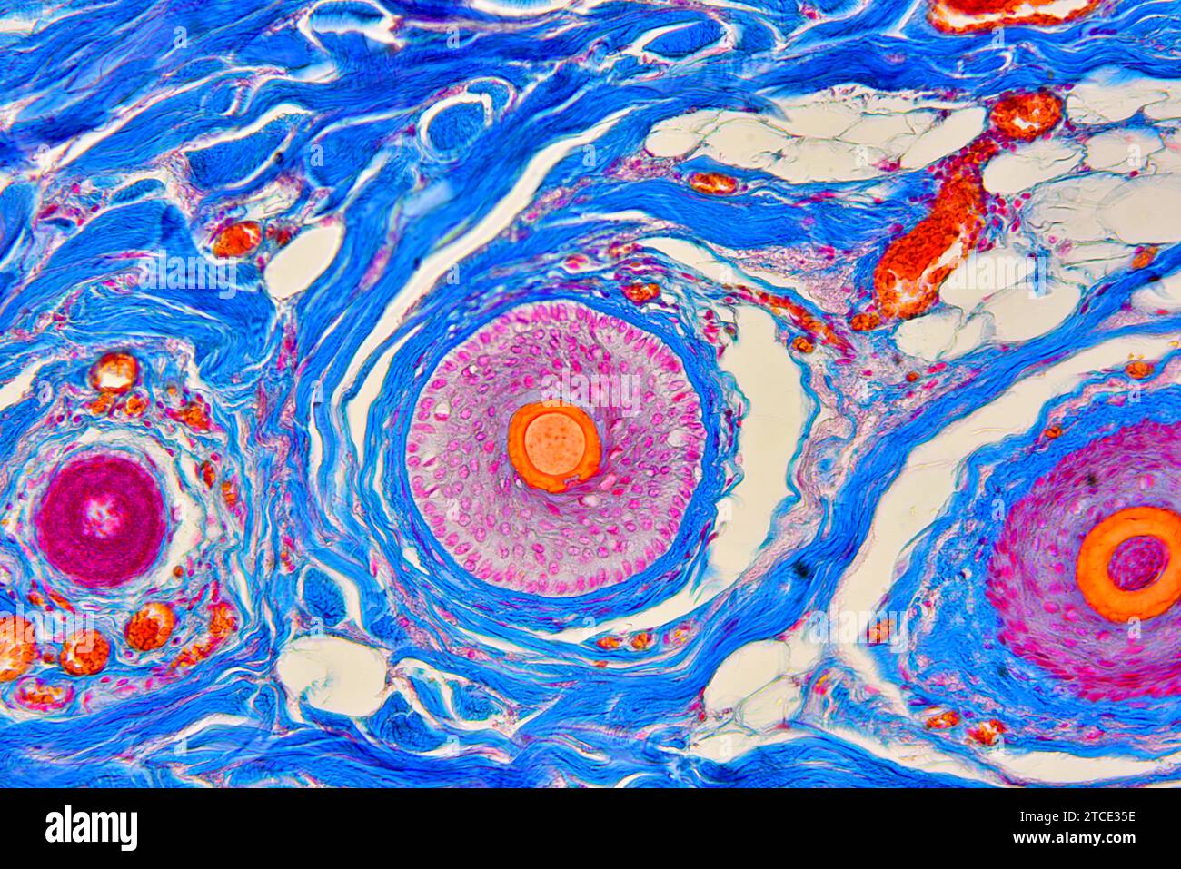 Human scalp cross section showing hair follicles and fibrous tissue ...
