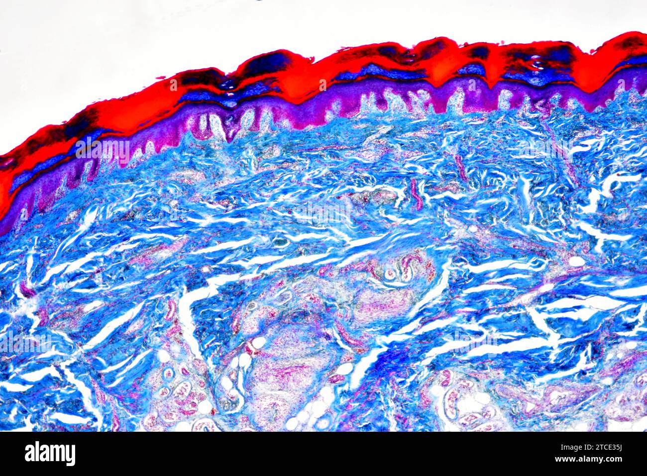 Human skin showing epidermis, dermis, blood vessels and collagen fibers ...