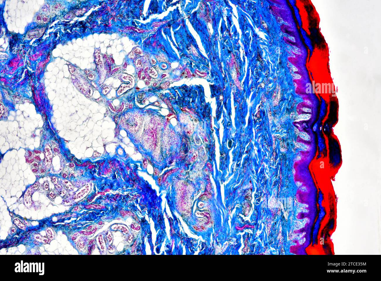 Human skin showing epidermis, dermis, adipose tissue, blood vessels and ...