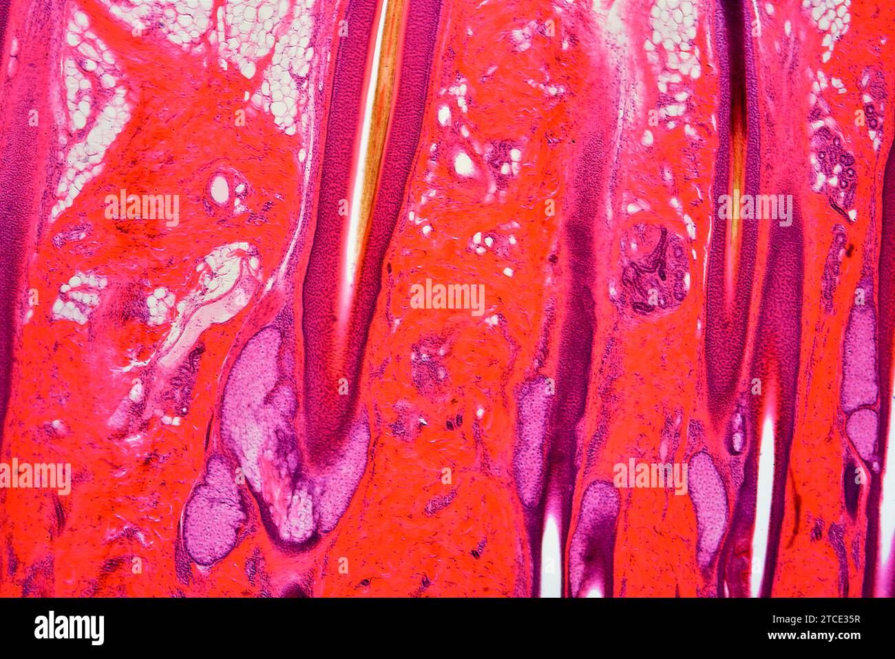 Human scalp transversal section showing hair follicles, sebaceous ...