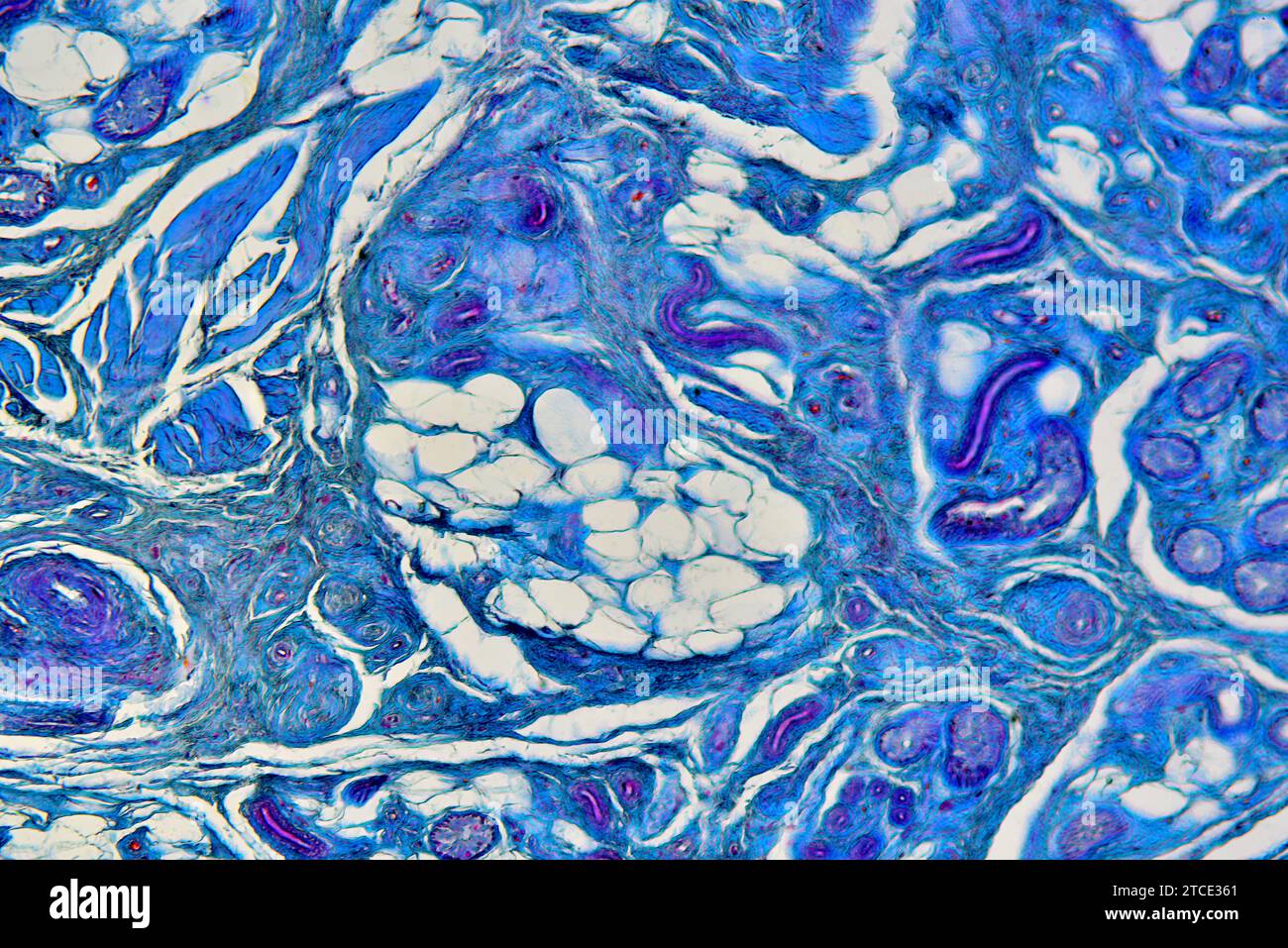 Human skin showing dermis with sweat gland, blood vessels and collagen ...