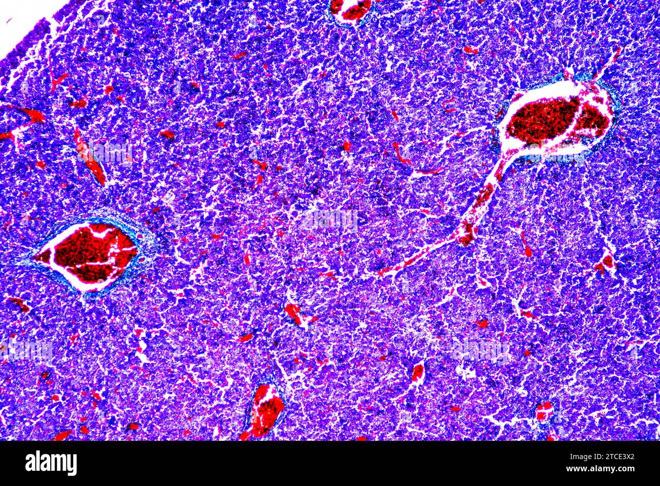 Human liver micrograph hi-res stock photography and images - Alamy