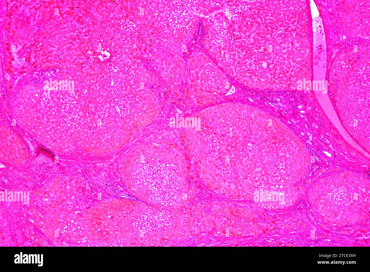 Liver Histology