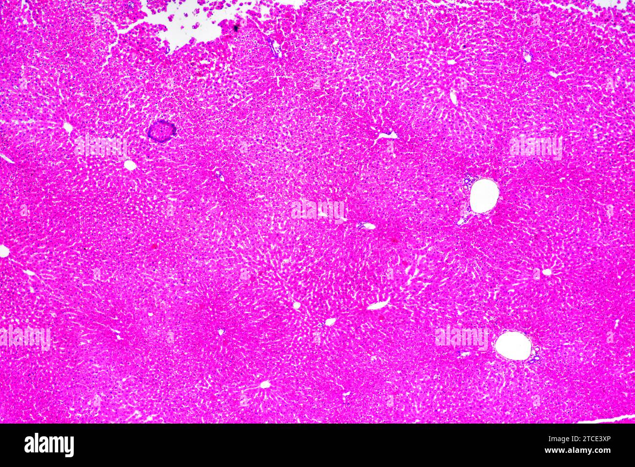 Human normal liver with hepatocytes and blood vessels. Optical ...