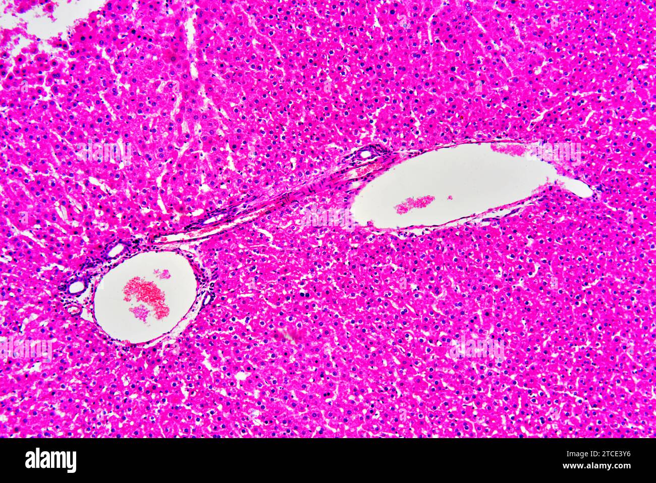 Human healthy or normal liver with hepatocytes and blood vessels ...