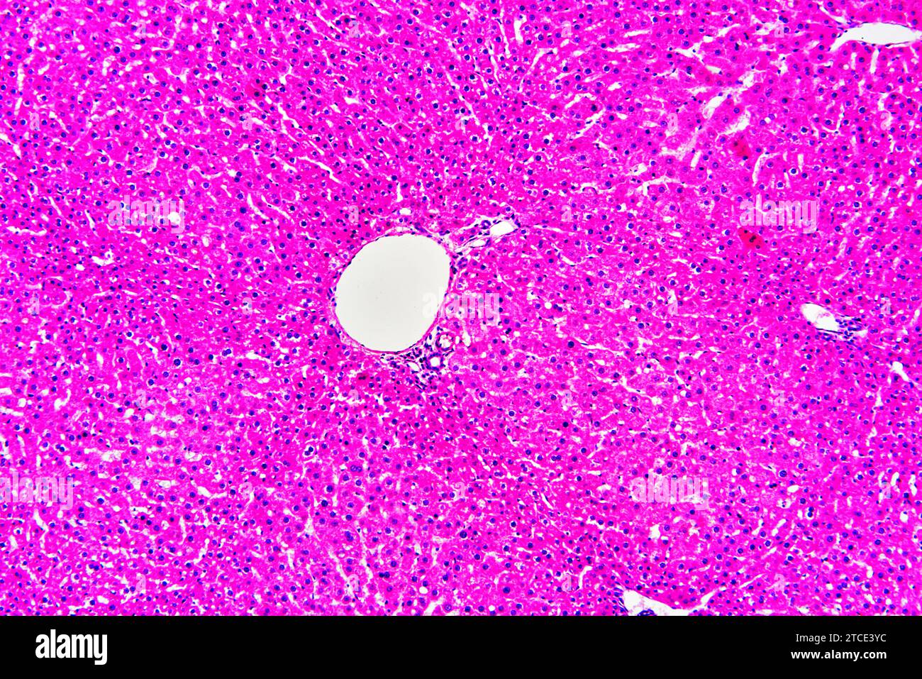 Human healthy or normal liver with hepatocytes and blood vessels ...