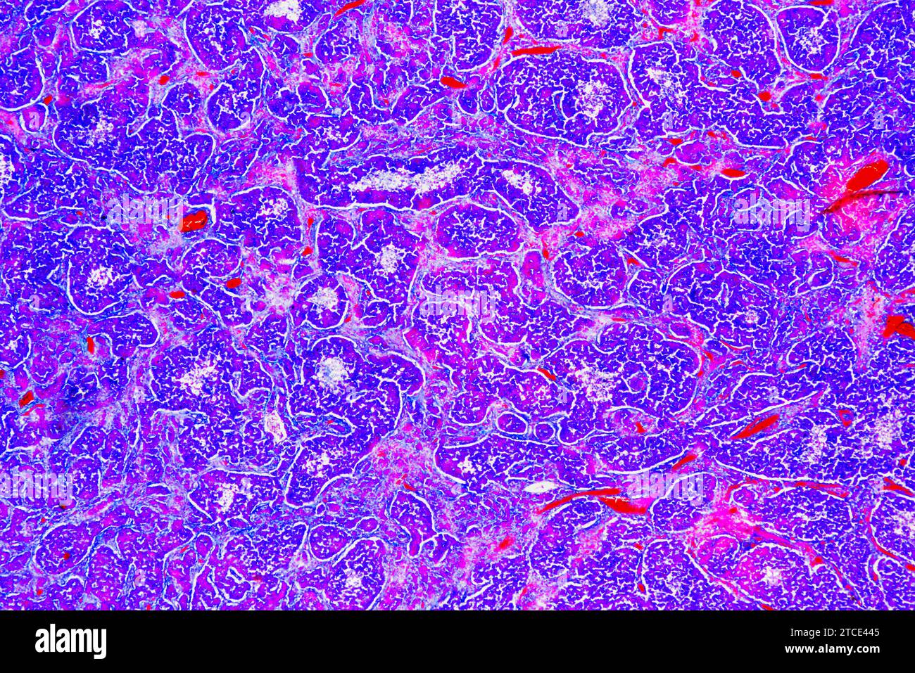 Pituitary gland hi-res stock photography and images - Alamy