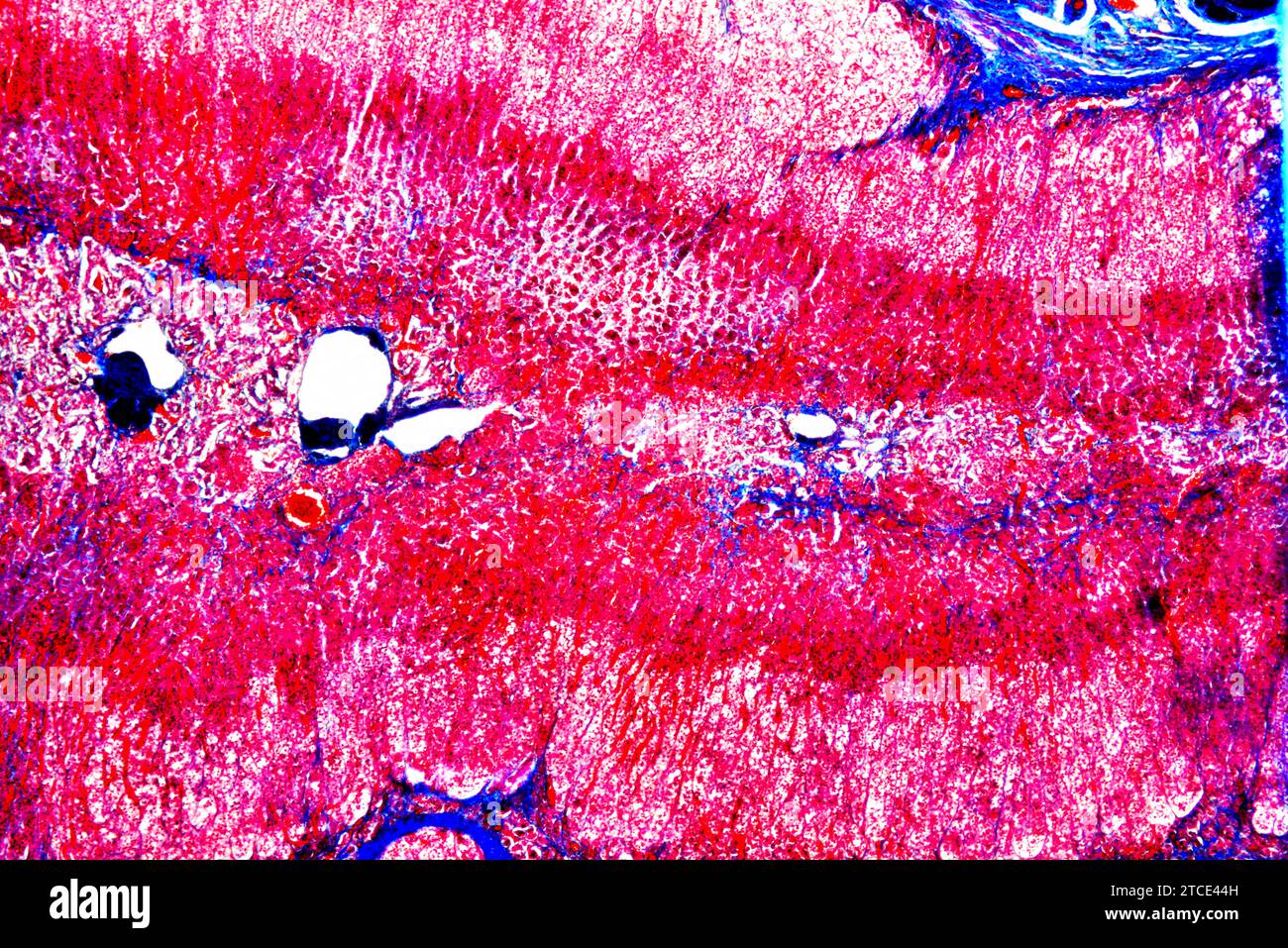 Adrenal gland glomerulosa hi-res stock photography and images - Alamy