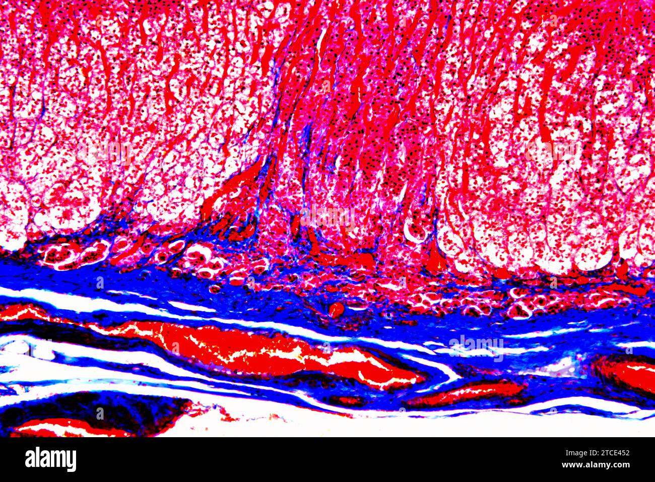 Human adrenal or suprarenal gland showing fibrous capsule, zona ...