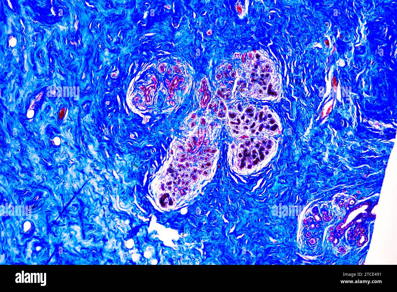 Human mammary gland. Optical microscope X100 Stock Photo - Alamy