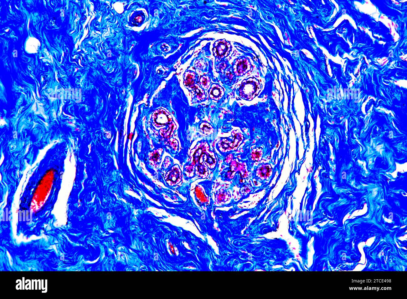 Human mammary gland. Optical microscope X100 Stock Photo - Alamy