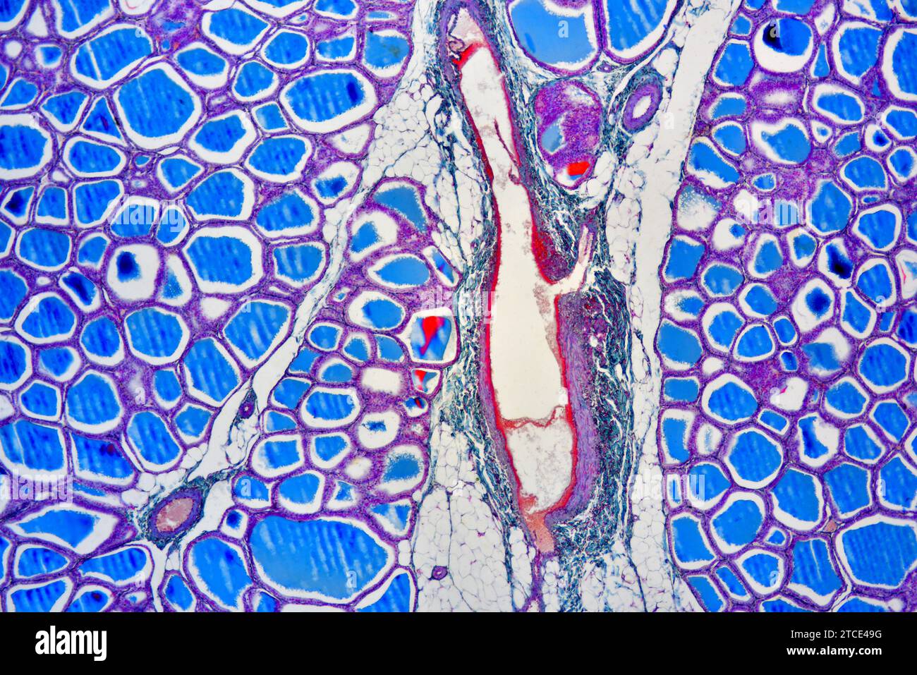 Human thyroid gland showing follicles, endothelial cells and follicular ...