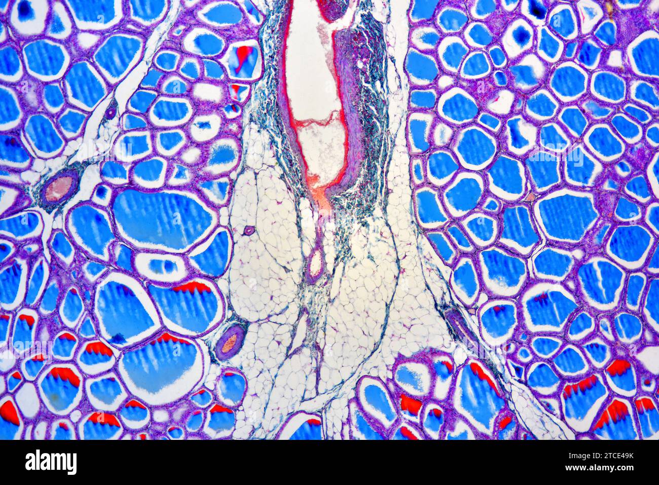 Human thyroid gland showing follicles, endothelial cells and follicular ...