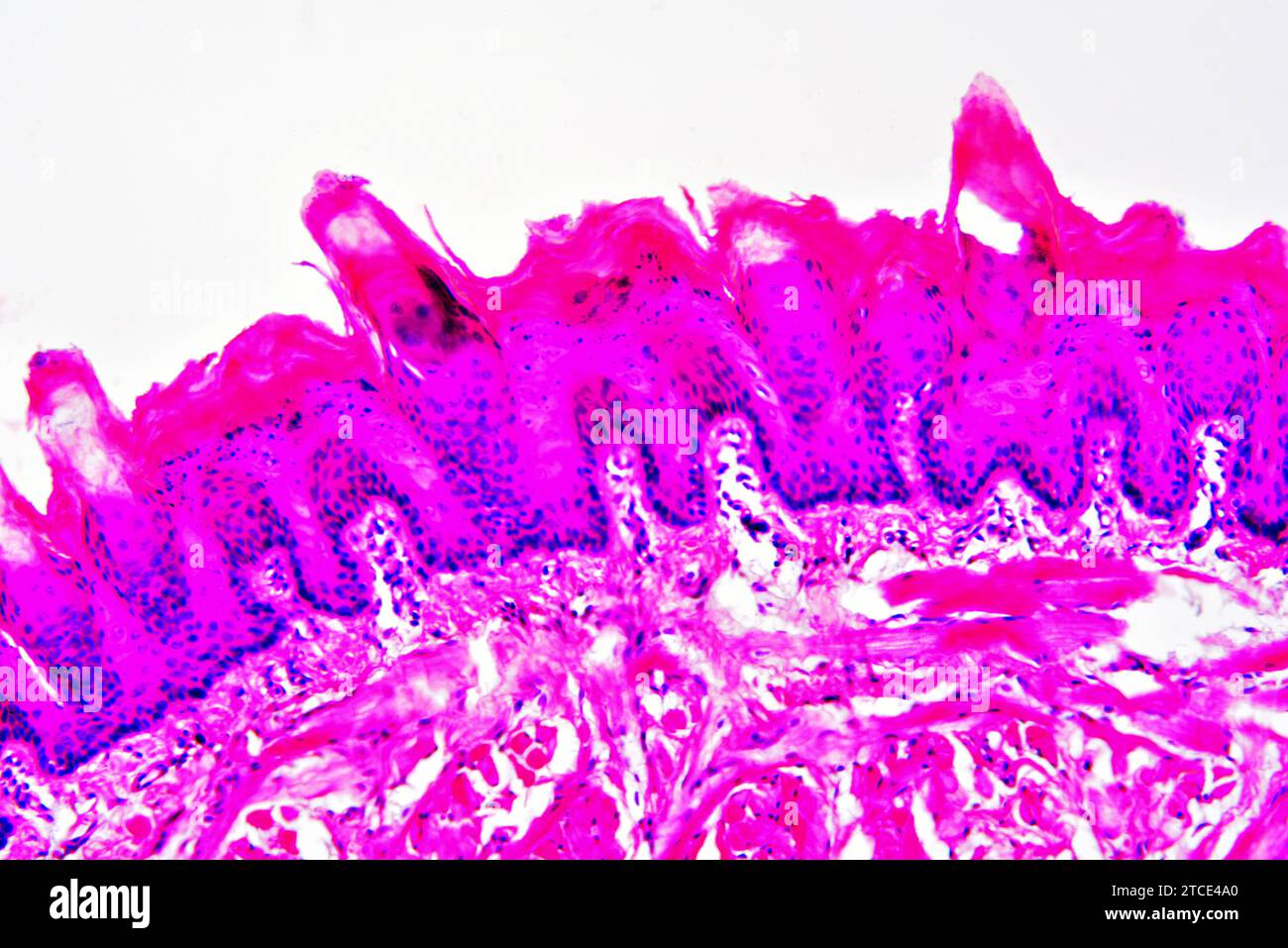 Tongue section showing lingual papillae, taste buds, striated muscles ... Tongue section showing lingual papillae, taste buds, striated muscles ...