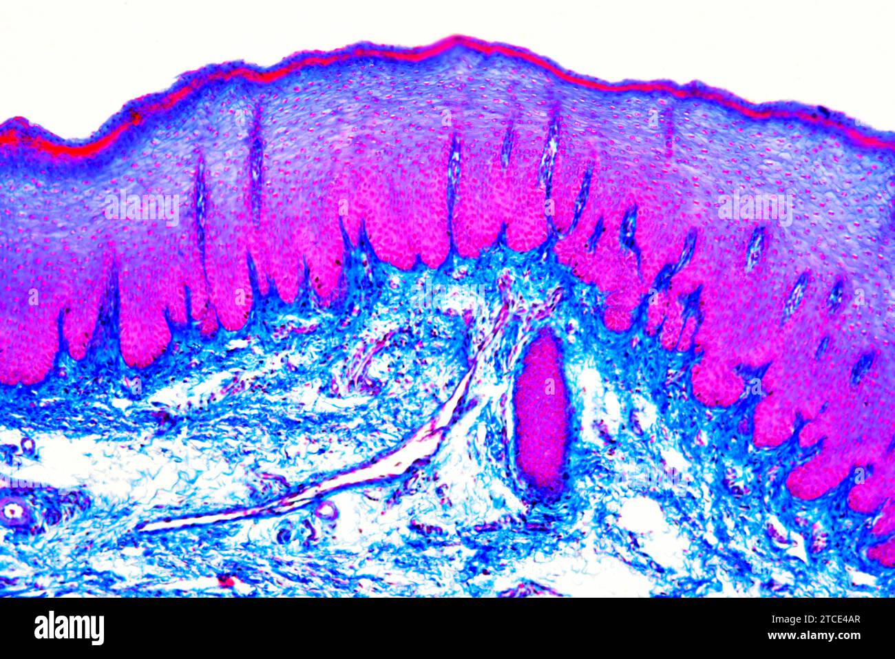 Tongue section showing taste buds, gustatory or Von Ebner glands ... Tongue section showing taste buds, gustatory or Von Ebner glands ...