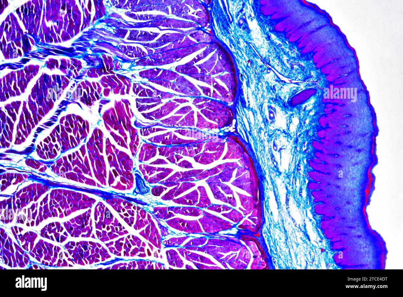 Tongue section showing taste buds, striated muscles and connective ...