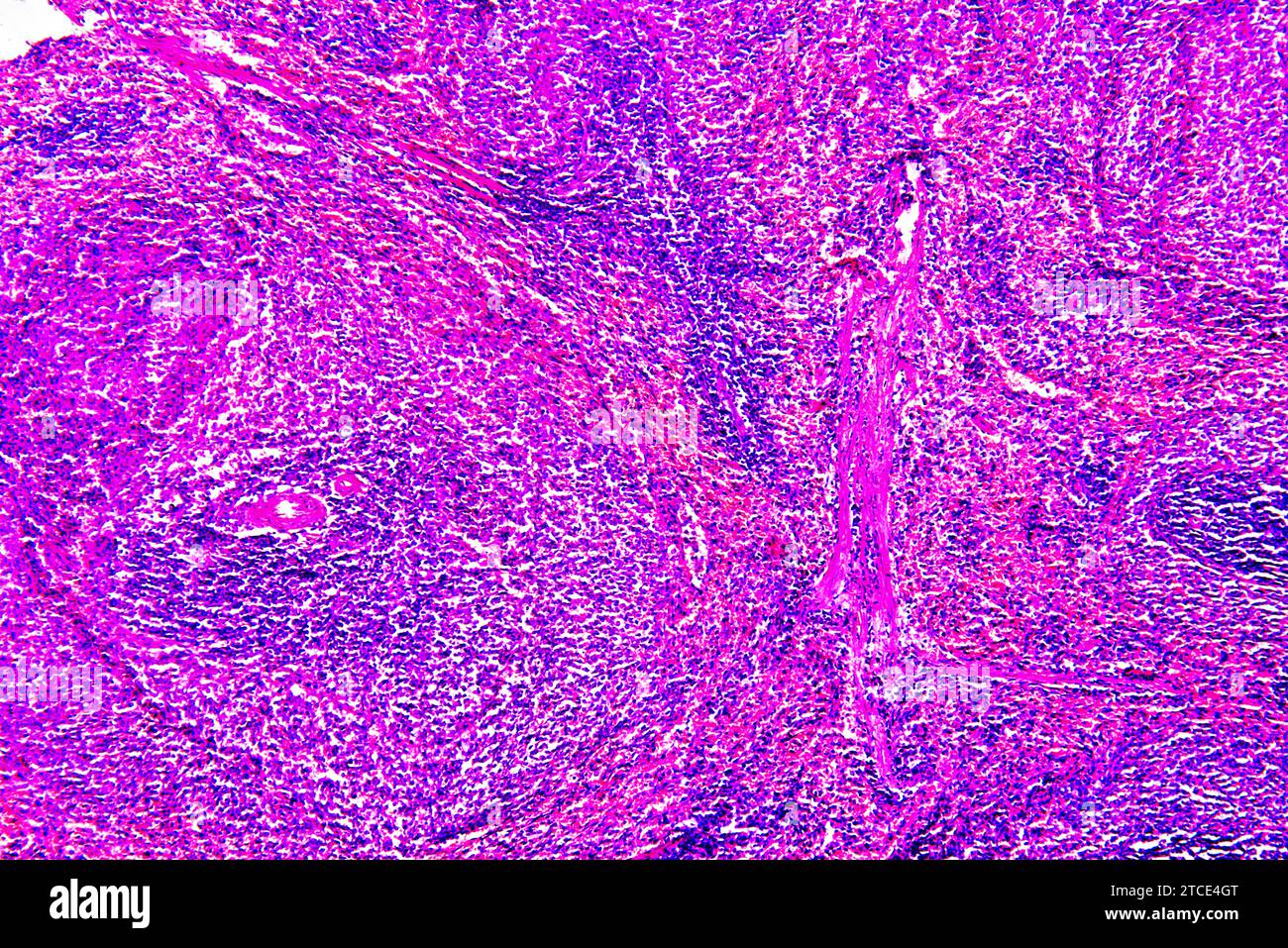 Human normal spleen. Optical microscope X100 Stock Photo - Alamy