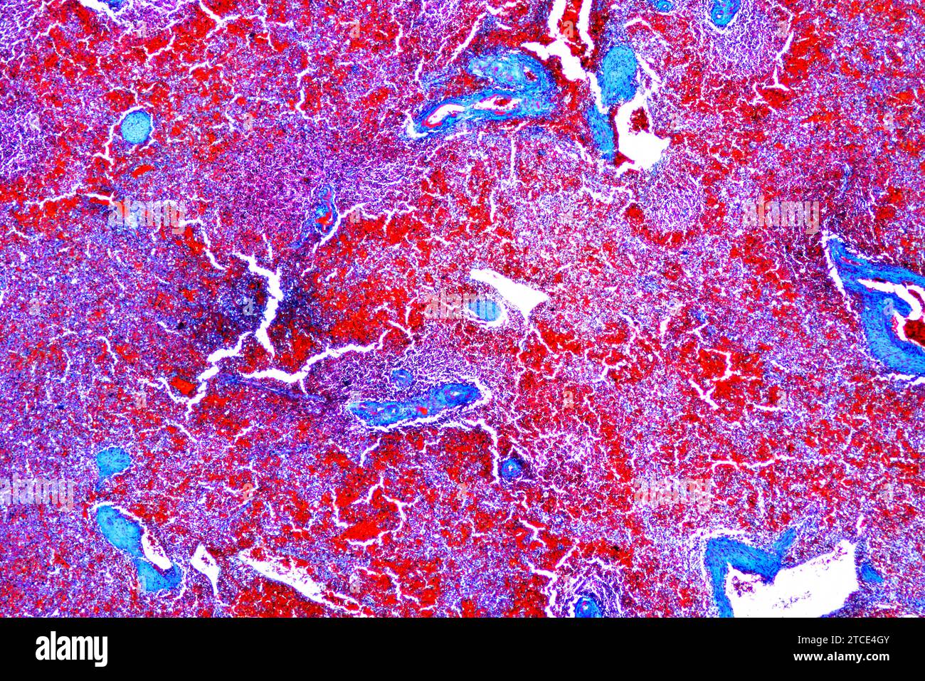 Human normal spleen. Optical microscope X40 Stock Photo - Alamy