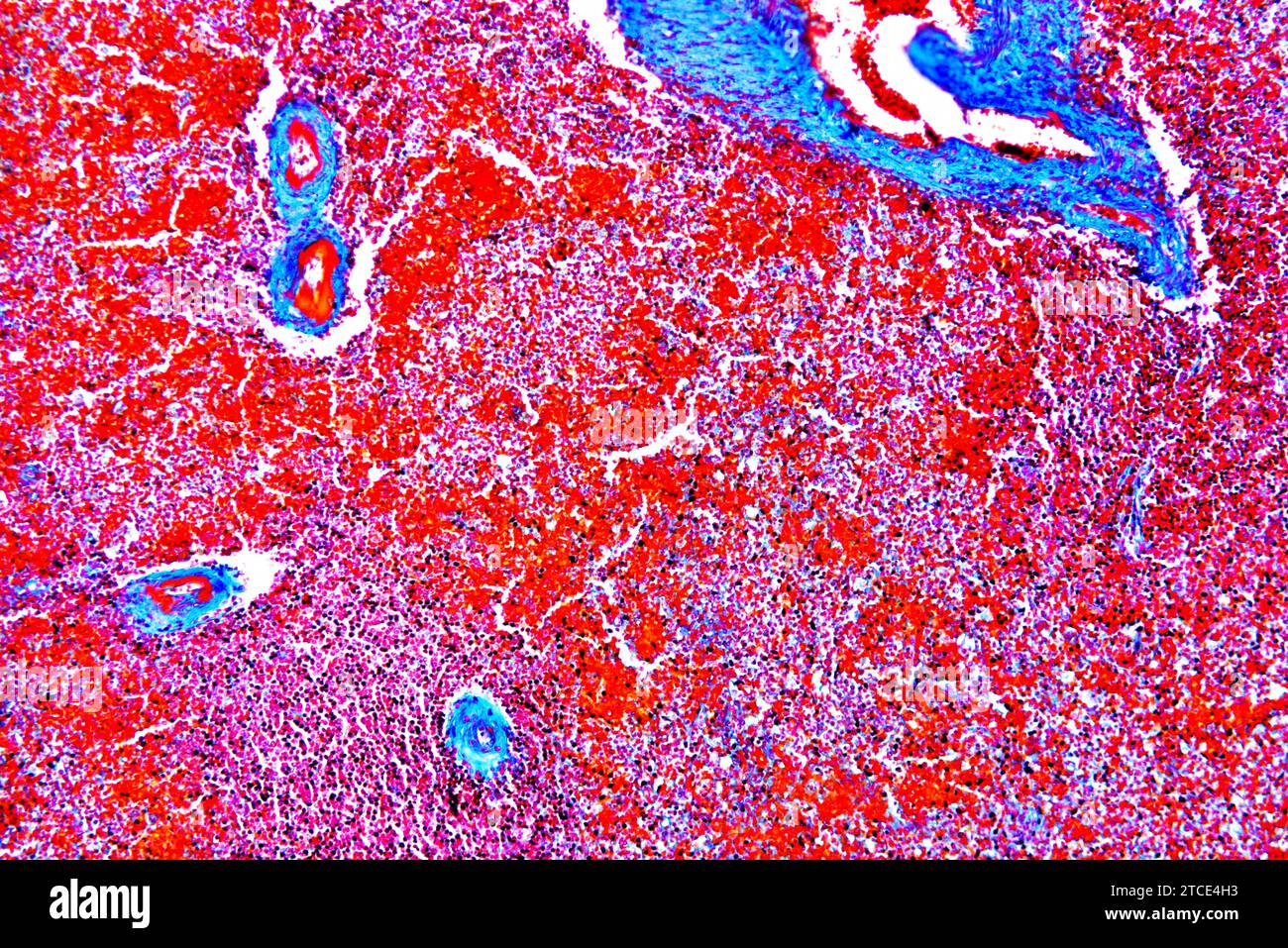 Human normal spleen. Optical microscope X100 Stock Photo - Alamy