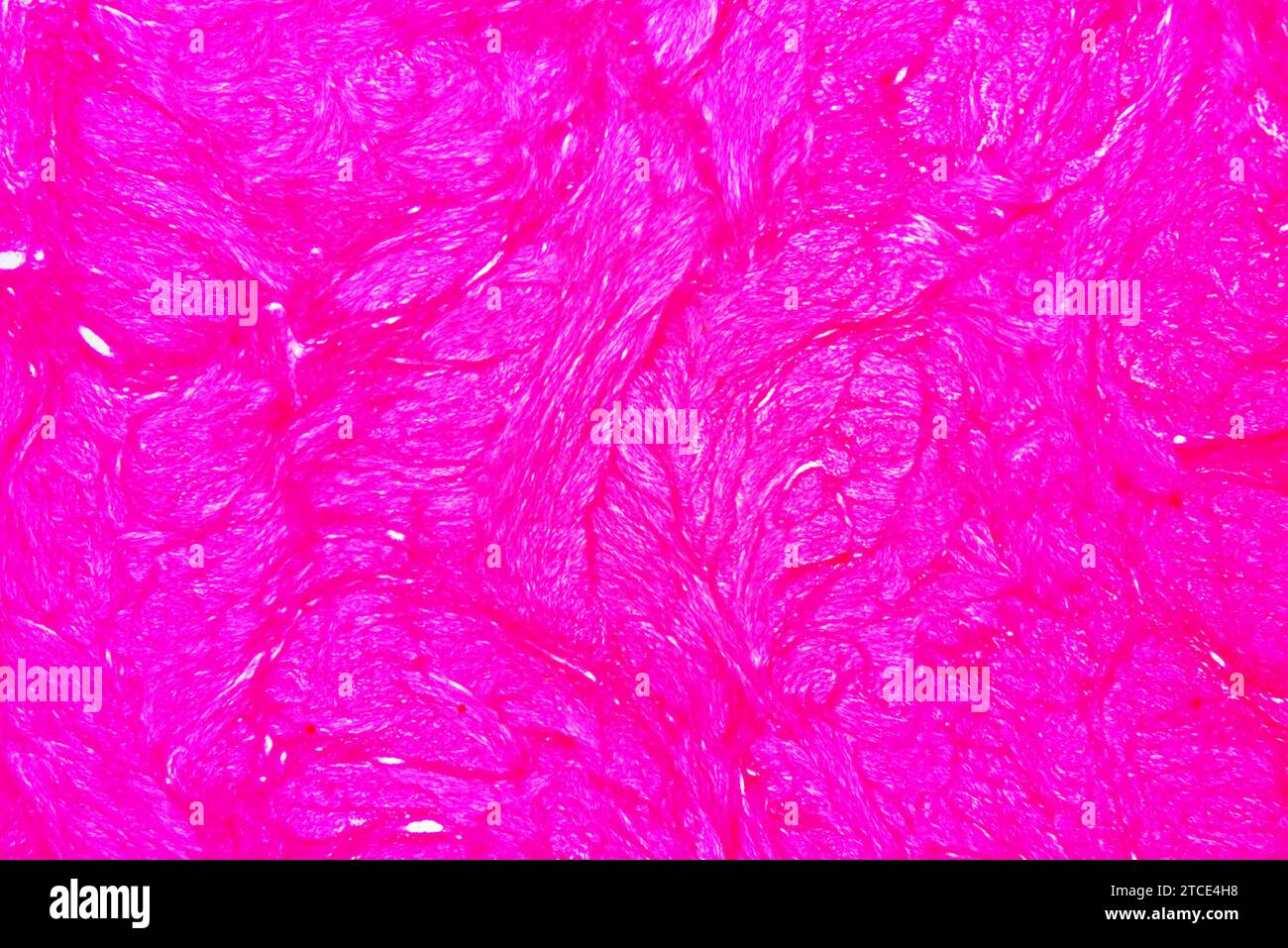 Uterine muscle hi-res stock photography and images - Alamy