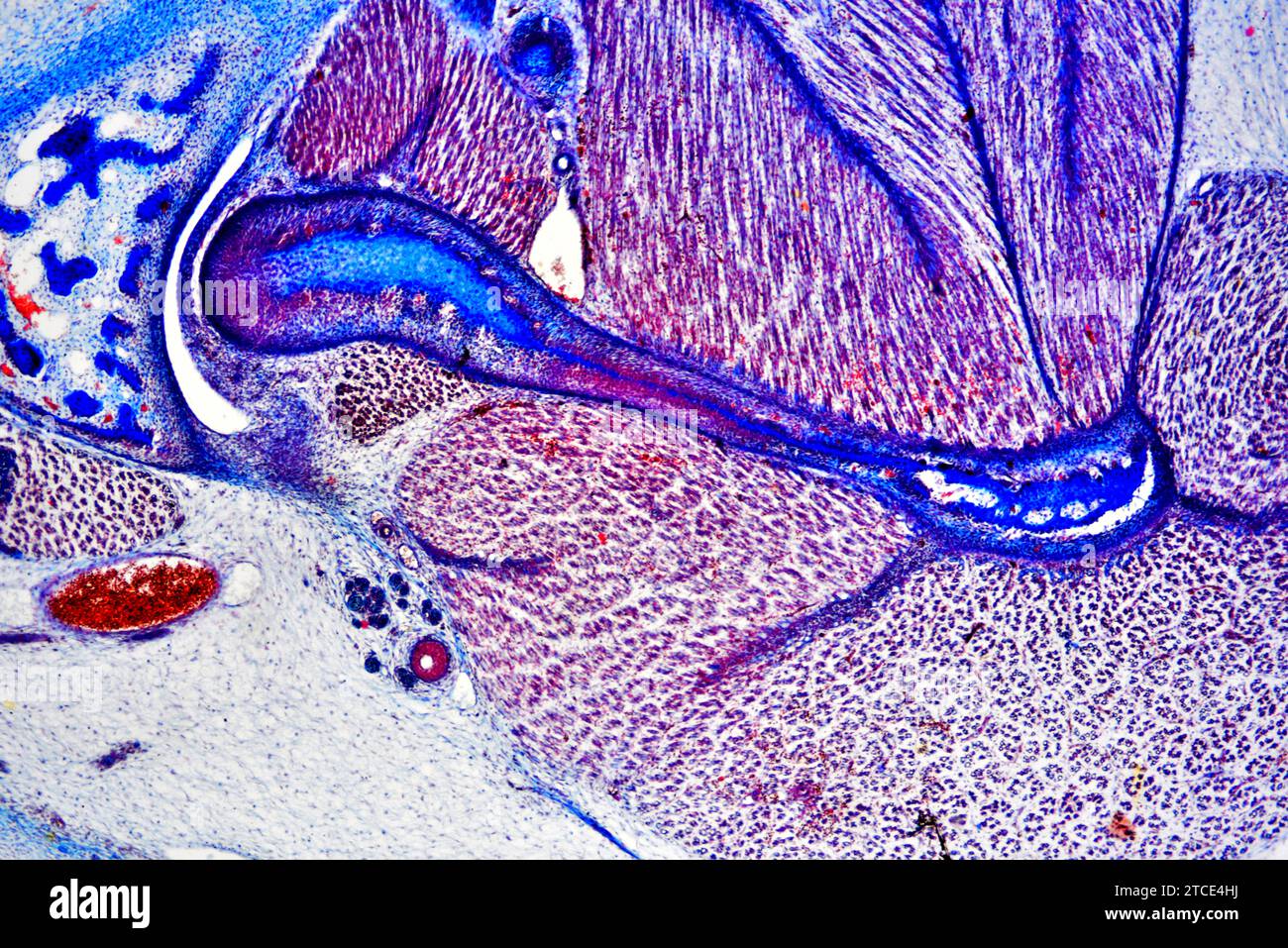 Inner ear with cochlea and tympani. Optical microscope X40 Stock Photo ...