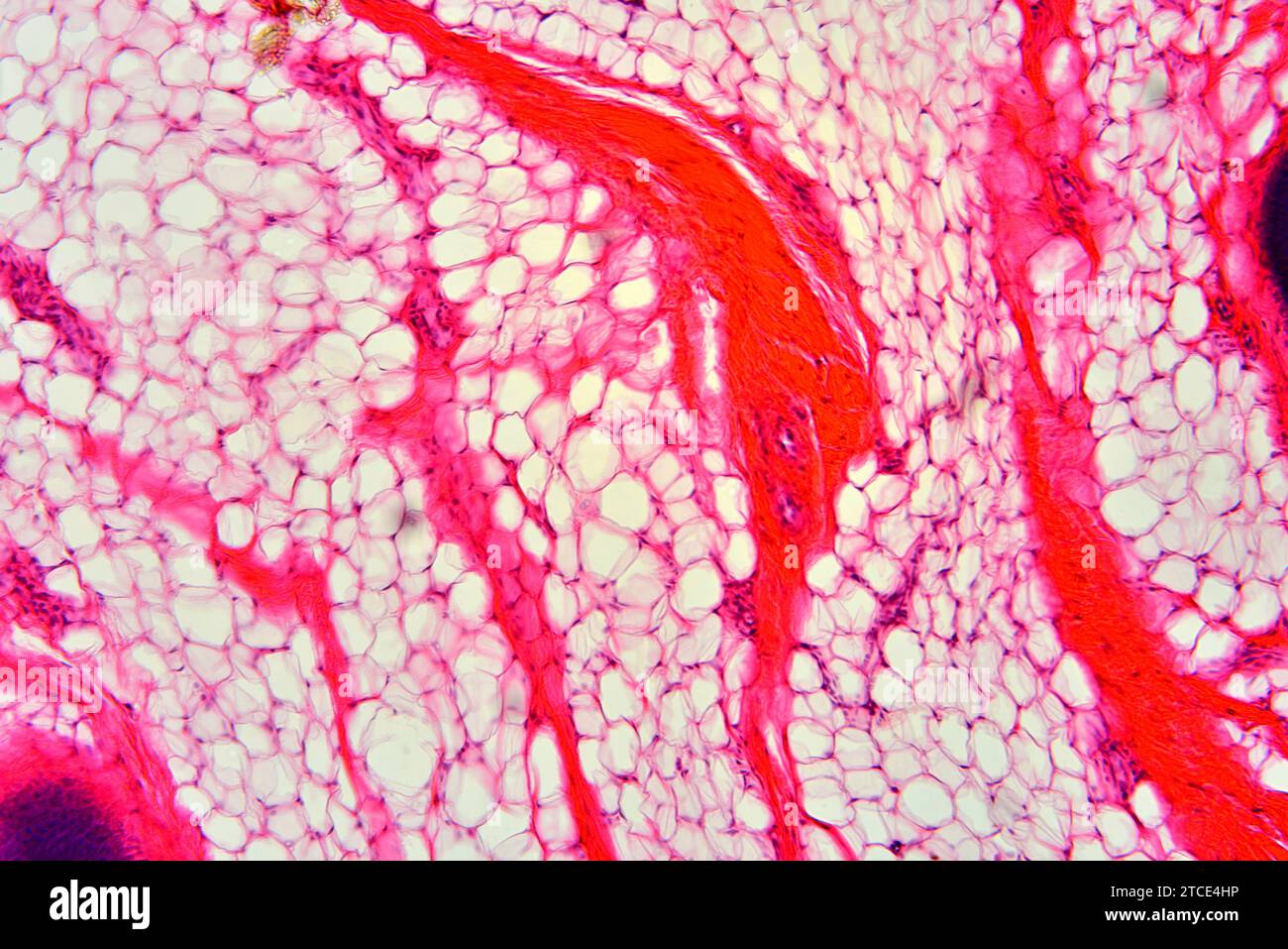Adipose tissue from skin. Optical microscope X100 Stock Photo - Alamy