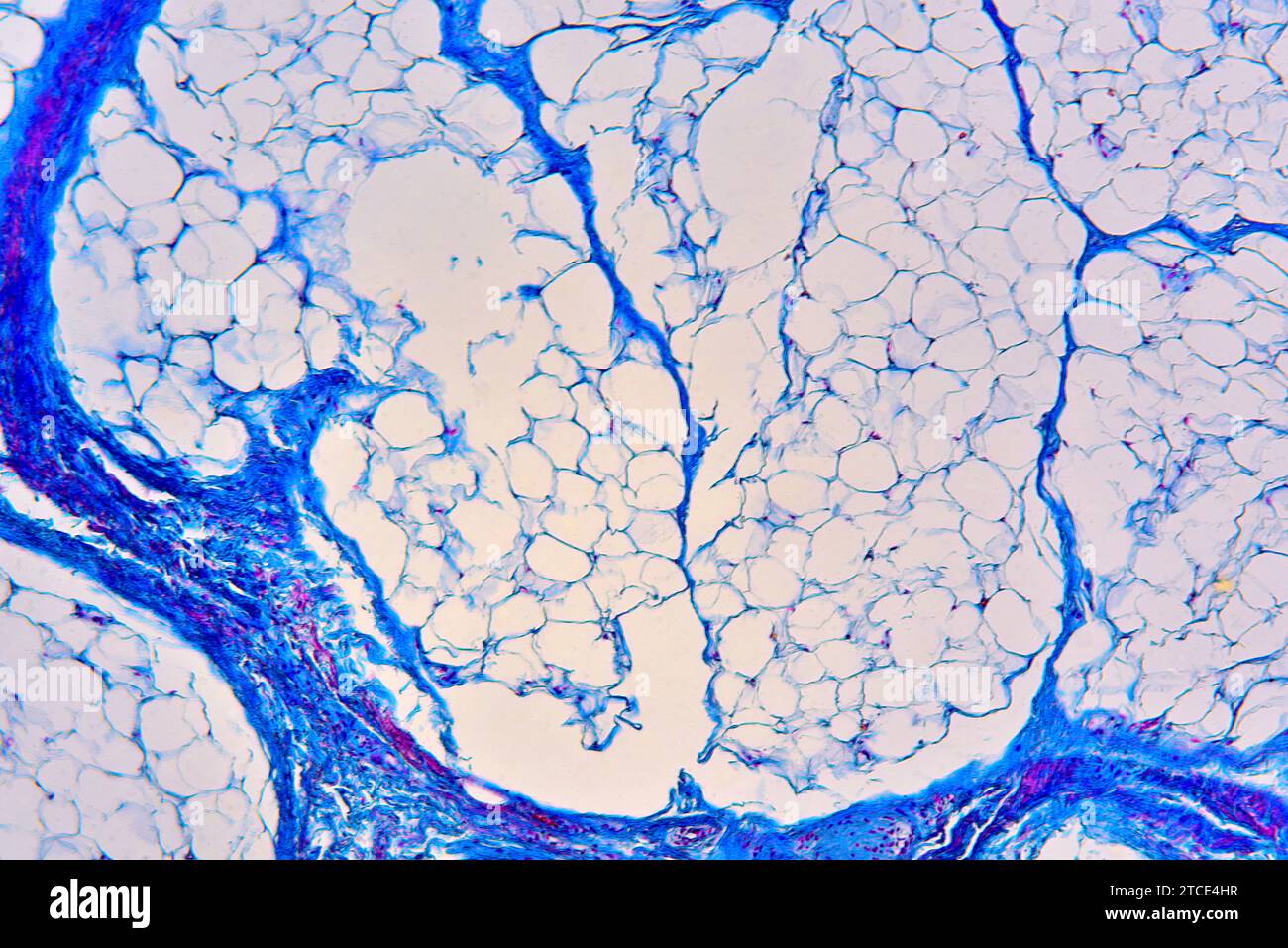 Adipose tissue. Optical microscope X100 Stock Photo - Alamy