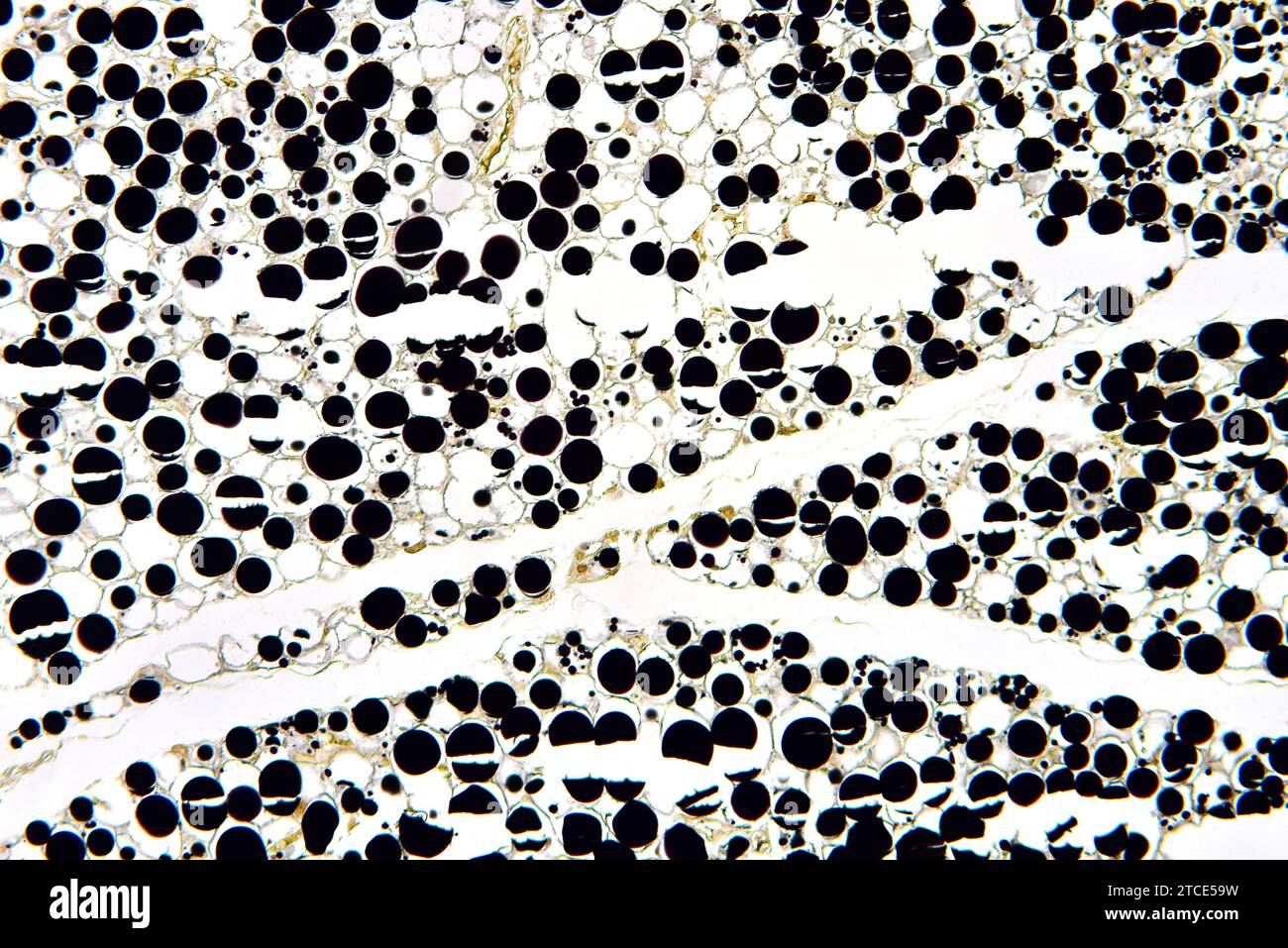 Adipose tissue. Optical microscope X100 Stock Photo - Alamy