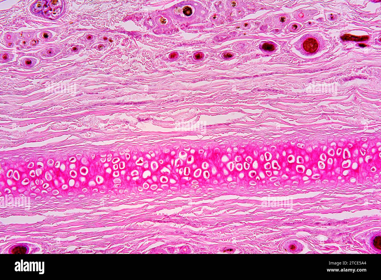 Elastic Cartilage Histology Ear
