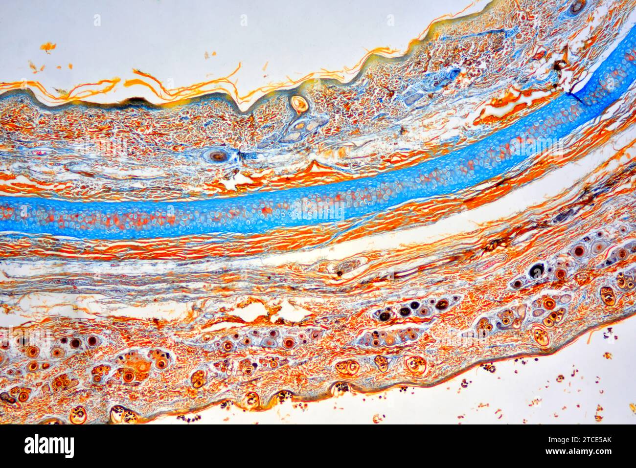 Elastic cartilaginous tissue from the ear showing chondrocytes, elastin ...