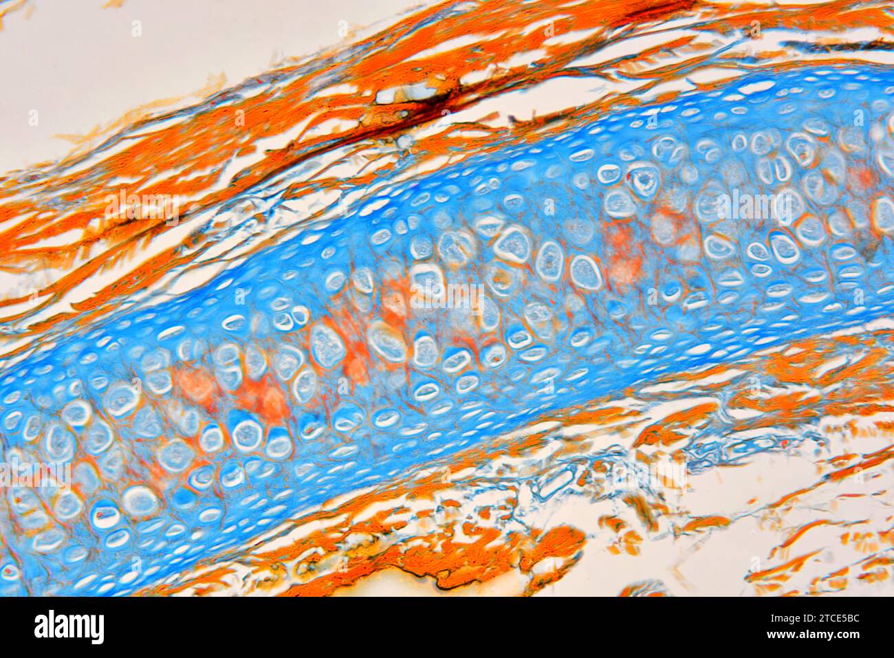 Elastic cartilaginous tissue from the ear showing Chondrocytes, elastin ...