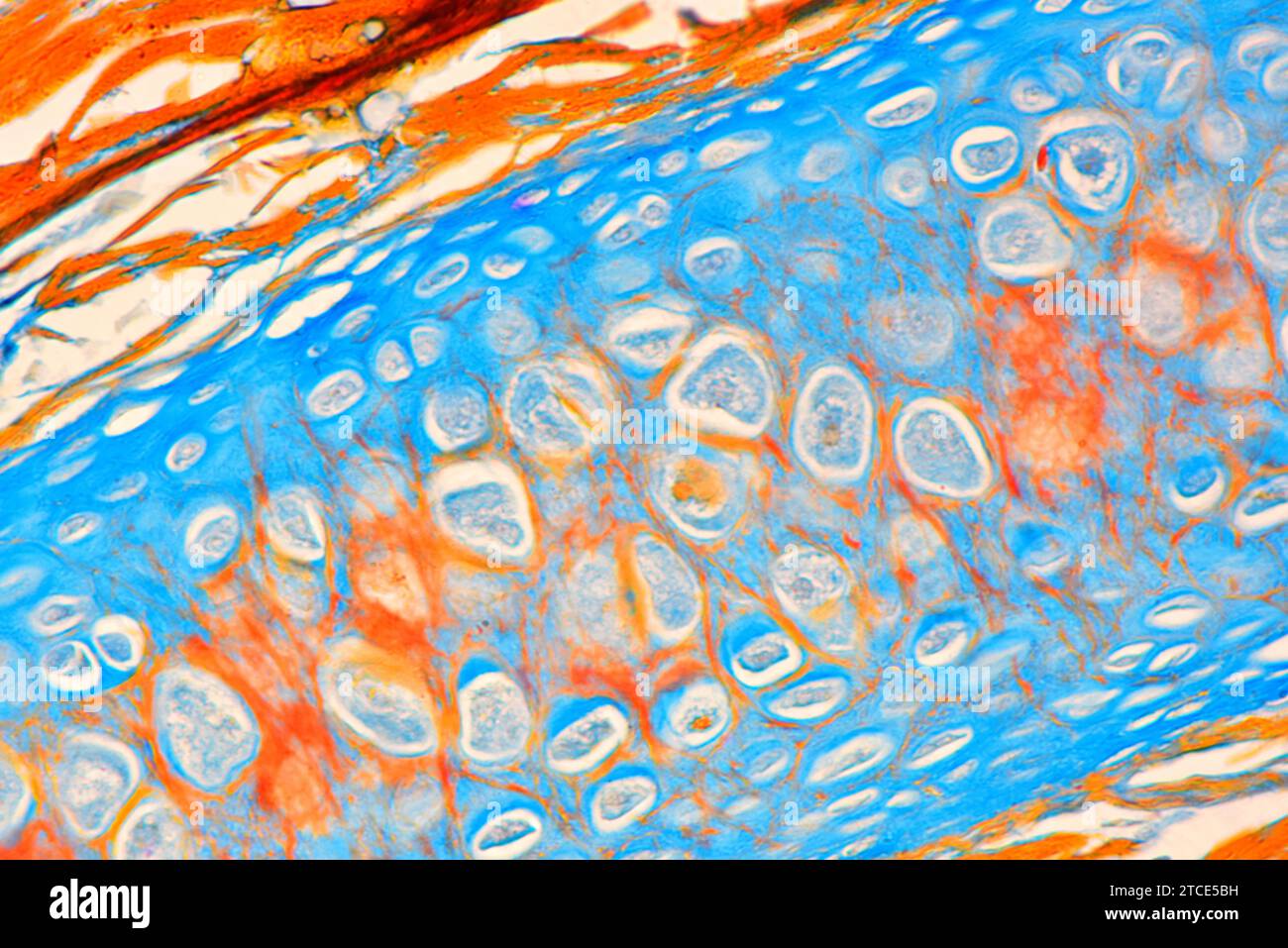 Elastic cartilaginous tissue from the ear showing chondrocytes, elastin ...