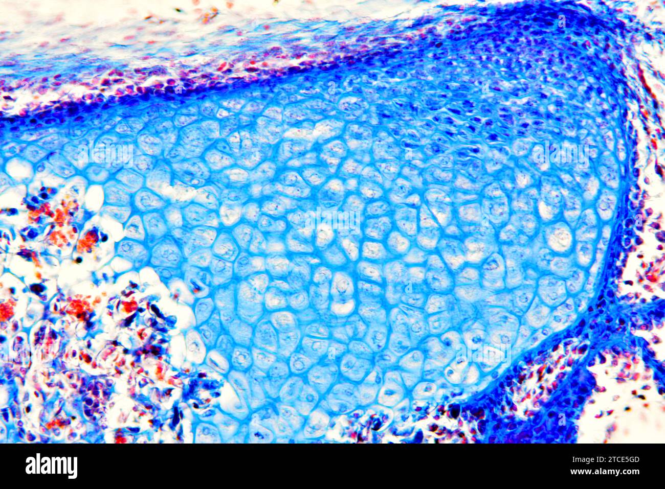 Elastic cartilaginous tissue from the ear showing chondrocytes, elastin ...