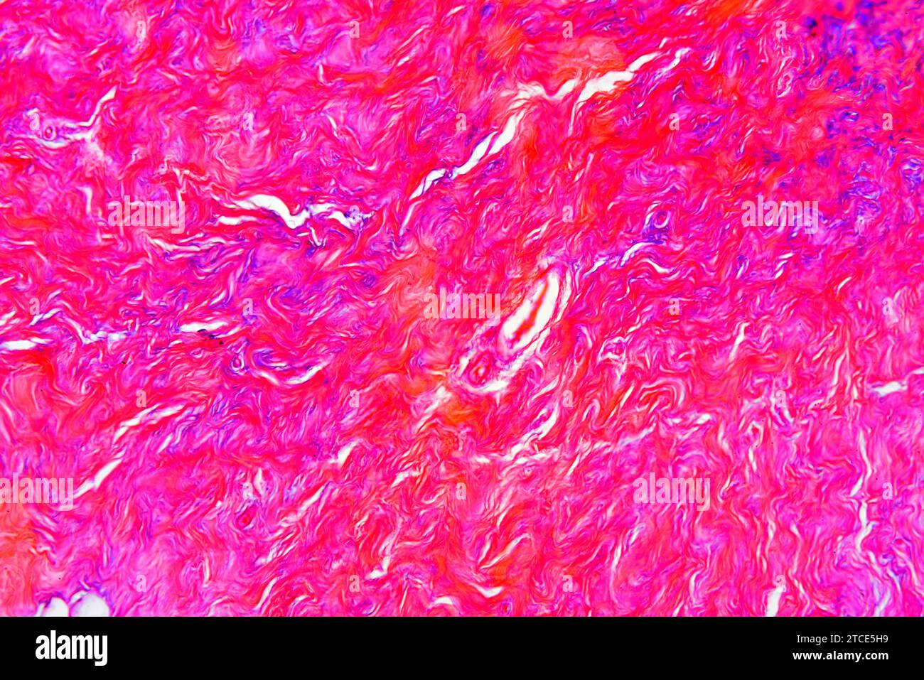 Fibrocartilage Tissue Showing Collagen Fibers Optical Microscope X100